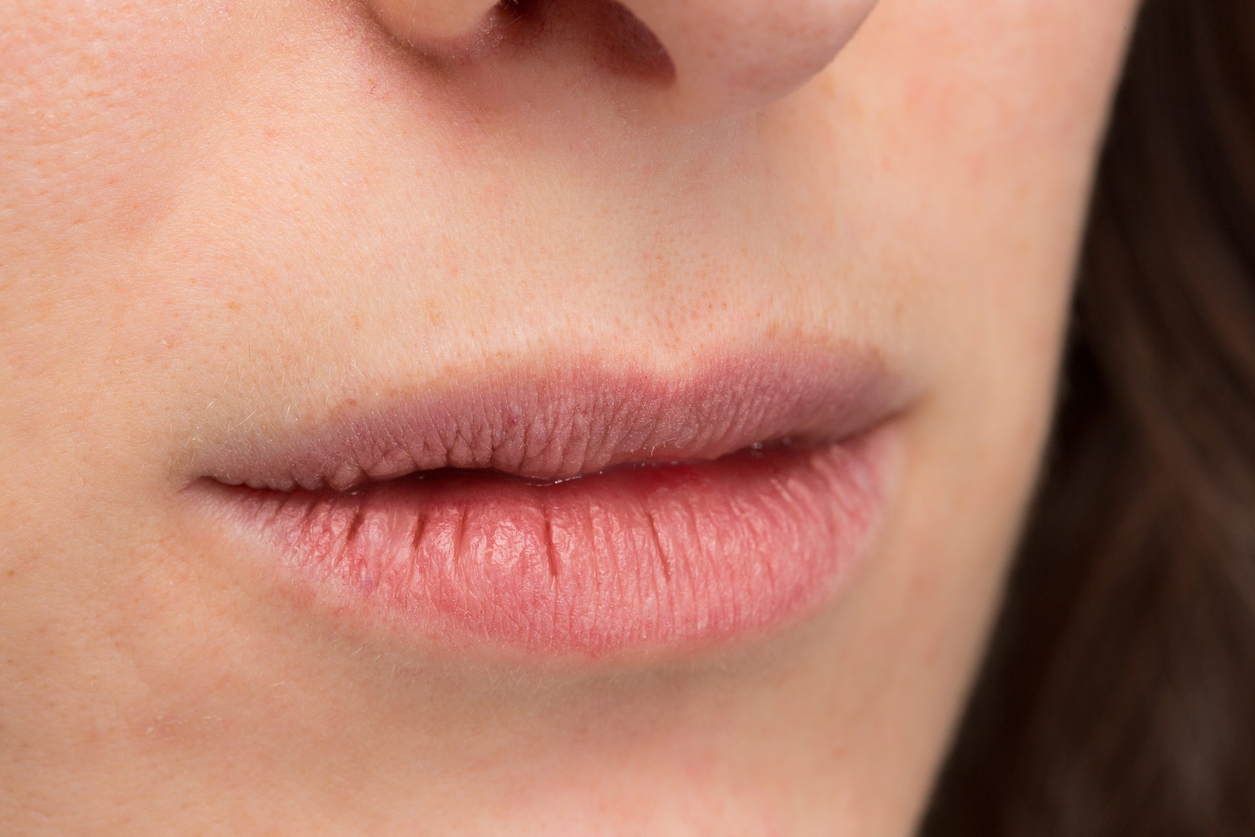 Dry Mouth Treatment London Symptoms Causes Dry Mouth Treatment London Symptoms Causes
